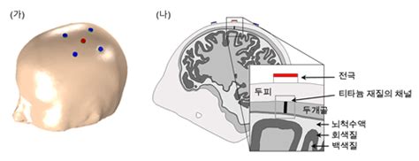 Gist 전성찬 교수 컴퓨터 시뮬레이션 기법을 통해 준침습성 뇌 전기 자극 효과 입증 문화and라이프 대한민국청소년기자단