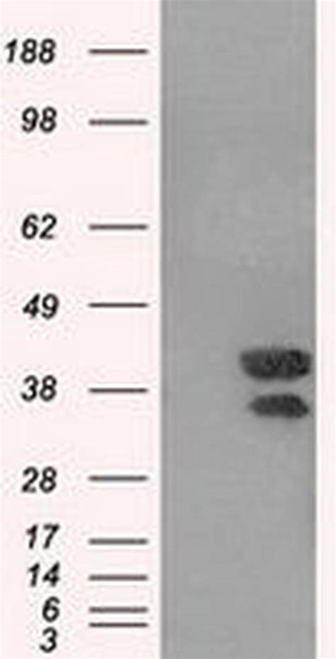 Dapk2 Monoclonal Antibody Oti1c8 Ta501087