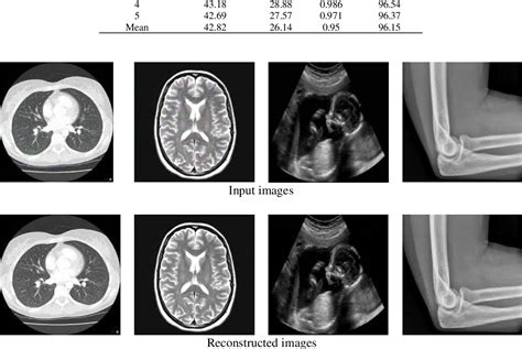Figure 1 From A Novel Compression Methodology For Medical Images Using