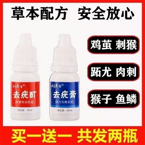 Corn Ointment Cure Corn Ointment Paste Old Calluses To Foot Pad Meat