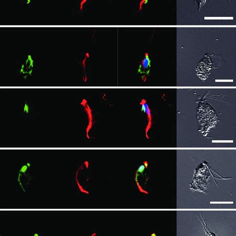 Immunofluorescence Localization In T Vaginalis Of The Five