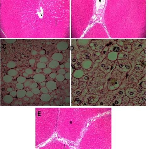 A A Photomicrograph Of Liver Section From Group 1 Control Group