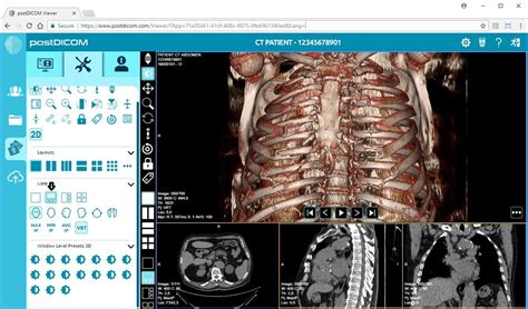 Dicom History At Frank Hamlin Blog