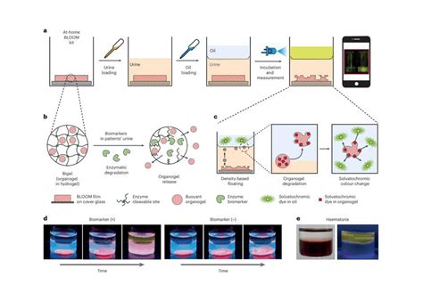 Home Test Kit Detects Bladder Cancer With 88 8 Accuracy Clinical Lab