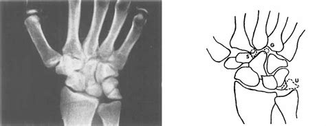 A Three Congenital Accessory Bones Download Scientific Diagram