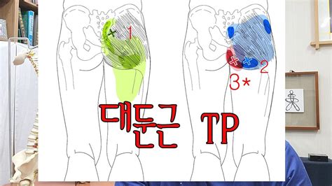 대둔근 Tp 공부만 열심히 하는 근육 Youtube