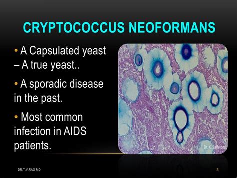Ppt Cryptococcus Neoformans Powerpoint Presentation Id 182746