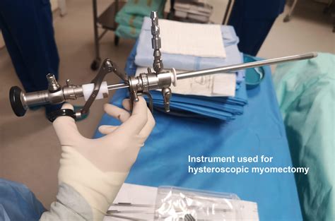 Hysteroscopy