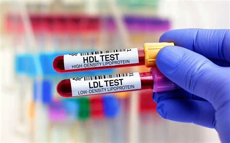 Cholesterol Ratio Calculator What It Is Why It Matters And How To