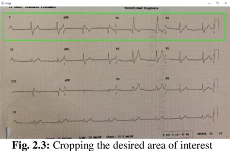 Figure 2 2 From Digitalization Of ECG Records Semantic Scholar