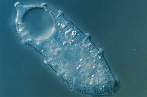 Discovery Of Rare Microbe Species Expands Tree Of Life Onedio