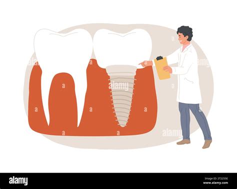 Teeth Dentures Implants Isolated Concept Vector Illustration Denture Implant Teeth Whitening
