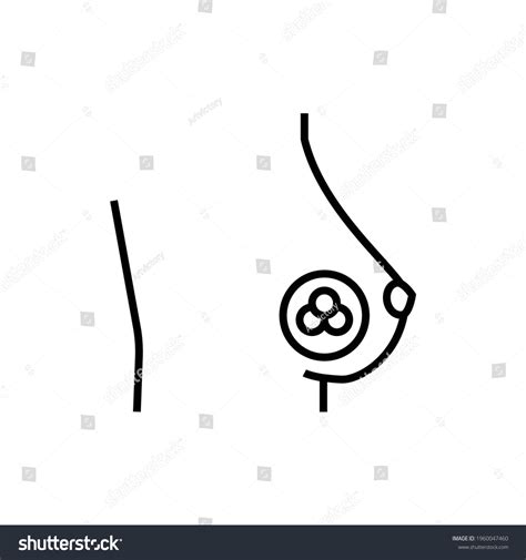 Breast Cancer Icon Malignant Neoplasm Vector Stock Vector Royalty Free