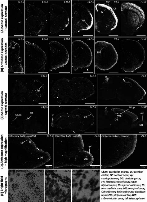 Radioactive Rna Ish Analysis Of Nrgn In The Developing Mouse Brain The Download Scientific