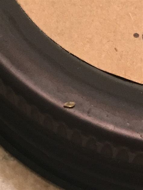 What Is Causing My Pores To Form These “plugs” R Acne