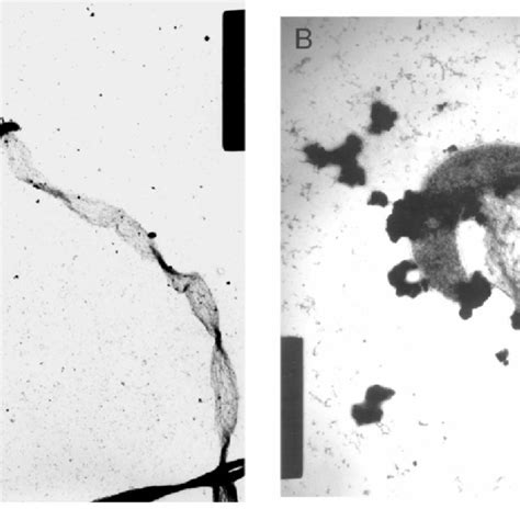 Pdf Biologically Induced Mineralization By Bacteria