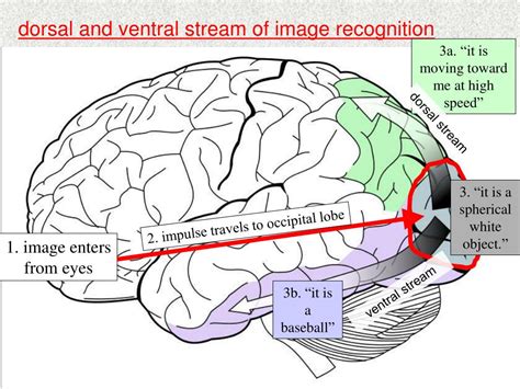 Gurney Journey Visual Form Agnosia