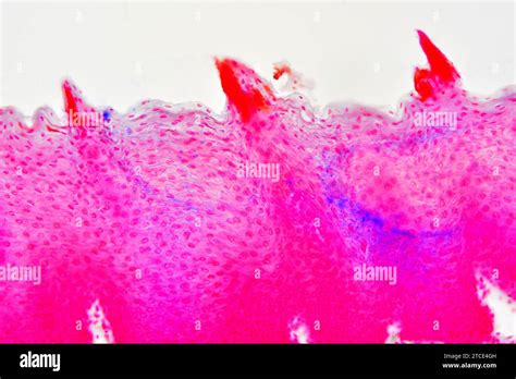 Tongue Section Showing Lingual Papillae Optical Microscope X200 Stock