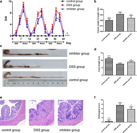The Effect Of Atx Lpa Axis On The Damage Of Colon In Dss Induced