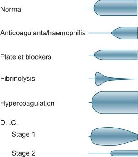 Examples Of Qualitative Teg Traces For Interpretation Download Scientific Diagram