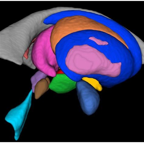 The 17 Subcortical Structures Currently Included In The Parcellation Download Scientific