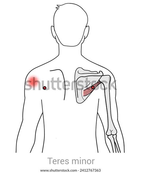 Myofascial Trigger Point Teres Minor Muscle Stock Illustration 2412767363 Shutterstock Myofascial Trigger Point Teres Minor Muscle Stock Illustration 2412767363 Shutterstock