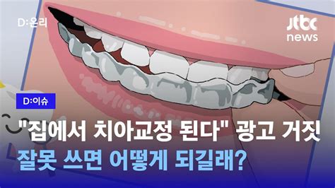 집에서 치아교정 된다거짓 광고에 불법 뭐길래｜d이슈 Youtube