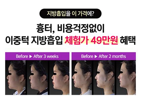 리팅성형외과의원