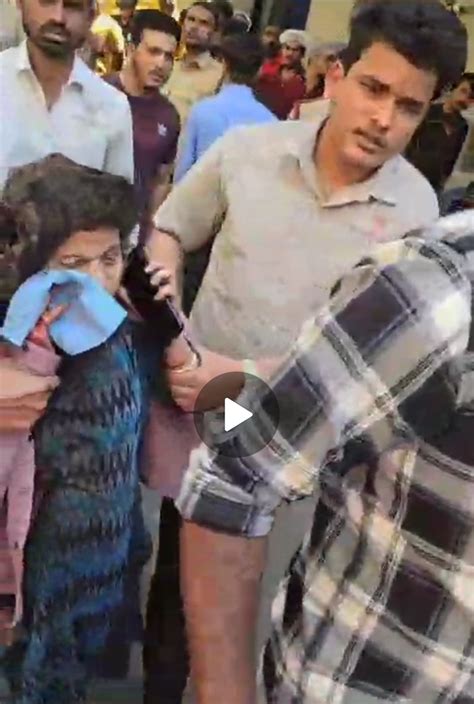 Accountant Who Bore Brunt Of Bengaluru Rameshwaram Cafe Blast Undergoes
