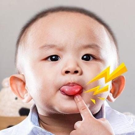 Ini Dia 6 Cara Mengobati Sariawan Yang Paling Ampuh