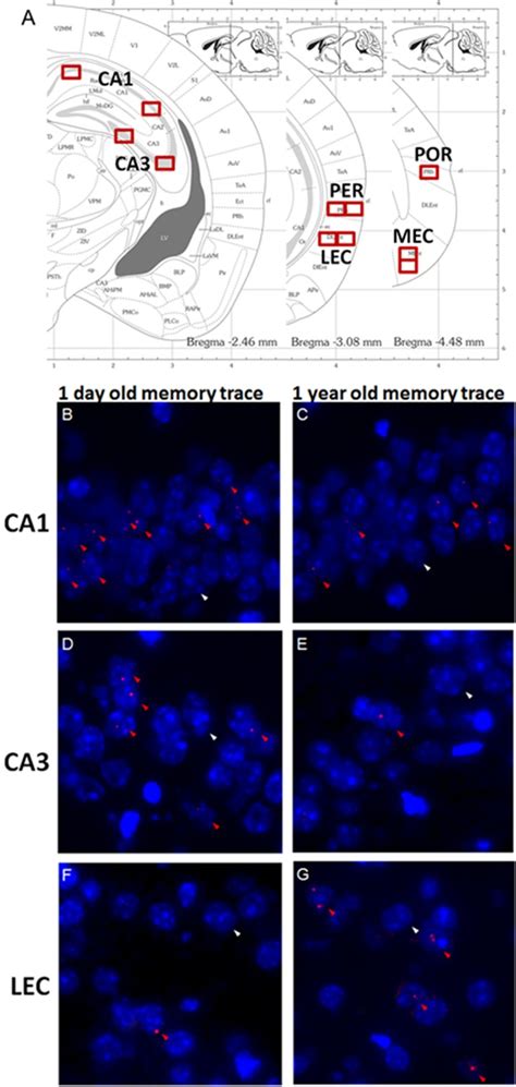 Imaging A Memory Trace Over Half A Life Time In The Medial Temporal