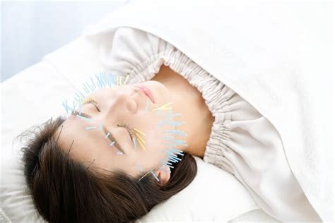 鍼灸はどんな症状に効果がある？痛みは？針治療の効果について詳しくまとめ コツマップ
