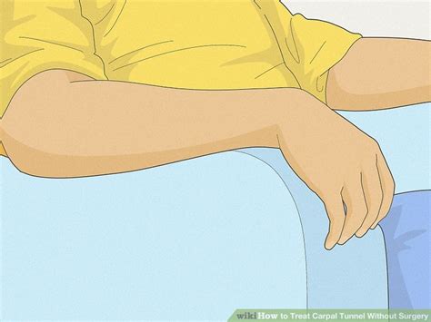4 Ways To Treat Carpal Tunnel Without Surgery Wikihow
