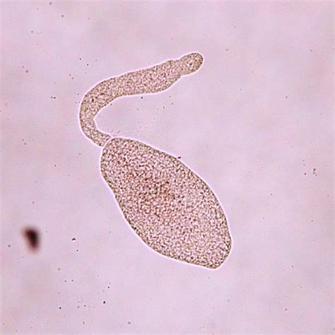 Developmental Stage Of A Metacestode Without Hooklets Download