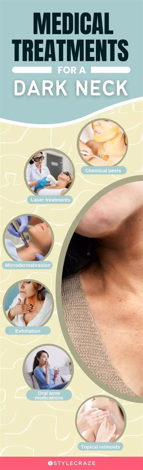 Dark Neck
