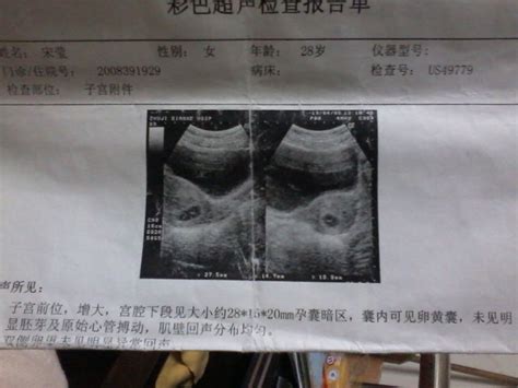 三个月的宝宝有多大 三个月图片 3一4个月宝宝图片 大山谷图库