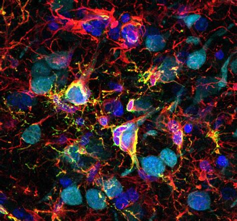 National Primate Research Centers On Linkedin Nonhuman Primate Research Offers Hope For Early