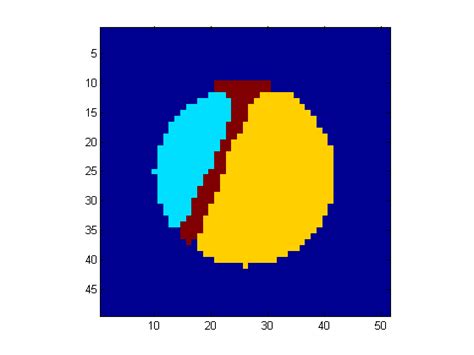 matlab segmenting a grayscale image stack overflow
