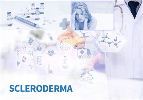 Systemic Scleroderma A Rare Disorder