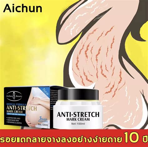 ครีมทาท้องลาย 100ml ลดรอยแตกลาย ครีมลดผิวแตกลาย ครีมขาลาย ครีมทาแก้ขา