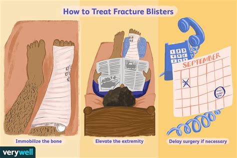 Skin Blisters After Severe Fractures Are Often Expected