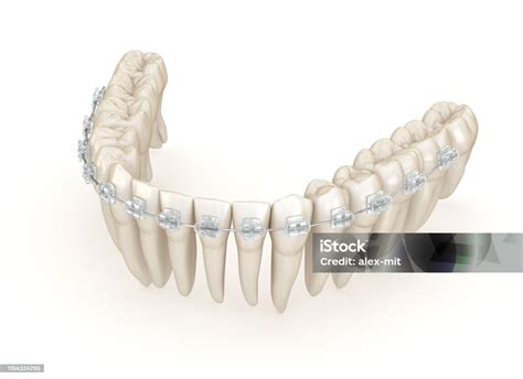 치아와 명확한 중괄호 3d 일러스트 컨셉 0명에 대한 스톡 사진 및 기타 이미지 0명 개념 구별하기 힘든 Istock