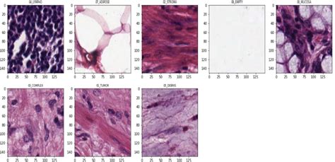 Figure From Colorectal Multi Class Image Classification Using Deep