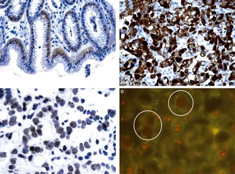 A 4b5 Immunohistochemistry Ihc Background Staining In Foveolar