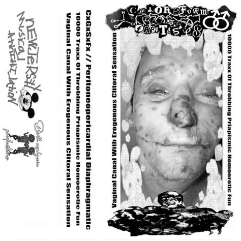 Split W Chloroform Gay Sex Fantasies Peritoneopericardial