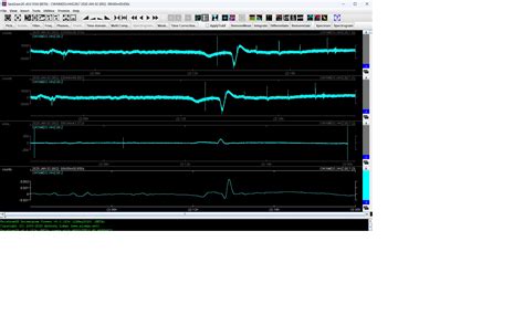 Questions On Instrument Response Removal Obspy Forum