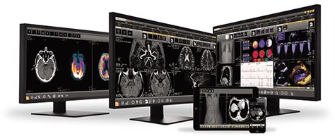 Paxera Health Medical Imaging Pacs Ris And Workflow Solutions
