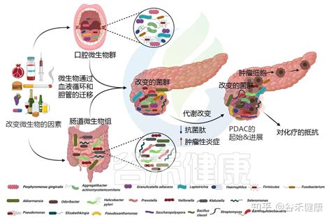 “隐藏高手”胰腺癌的新出路——微生物 知乎