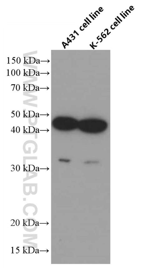 CCRL2 Mouse anti Human Clone 2C1E11 Proteintech 20 μL Unconjugated