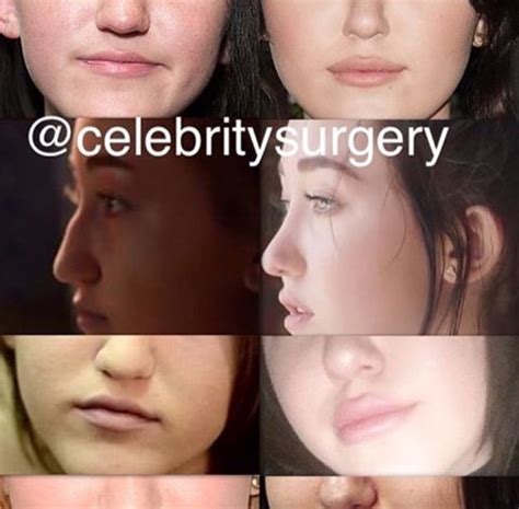 Looks Like Noah Cyrus Jumped On The Plastic Surgery Train Lipstick Alley